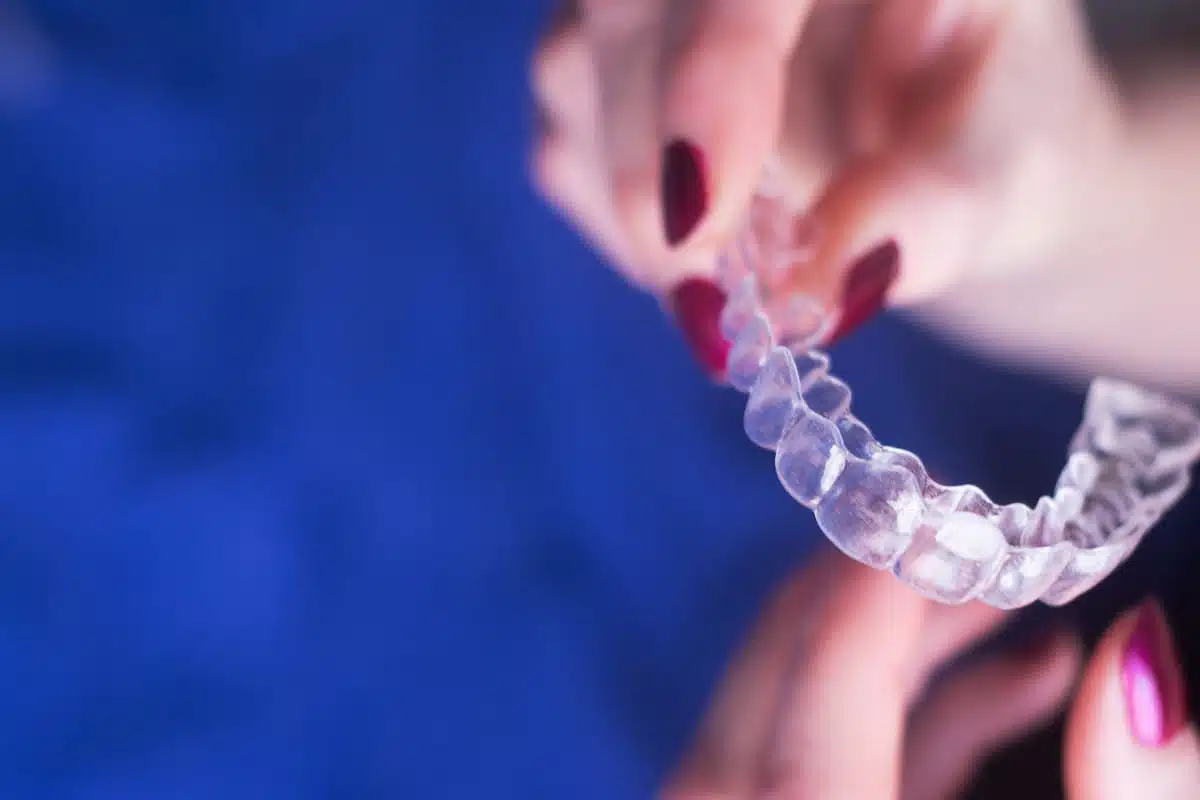 Aligner Erfahrungen: So verläuft meine Zahnkorrektur bisher