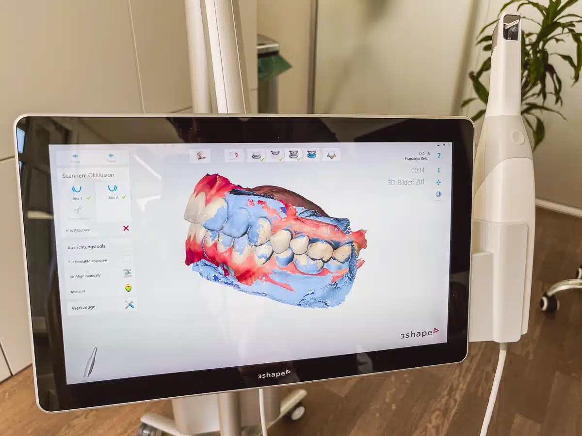 DrSmile 3D scan: All information about technology and procedure